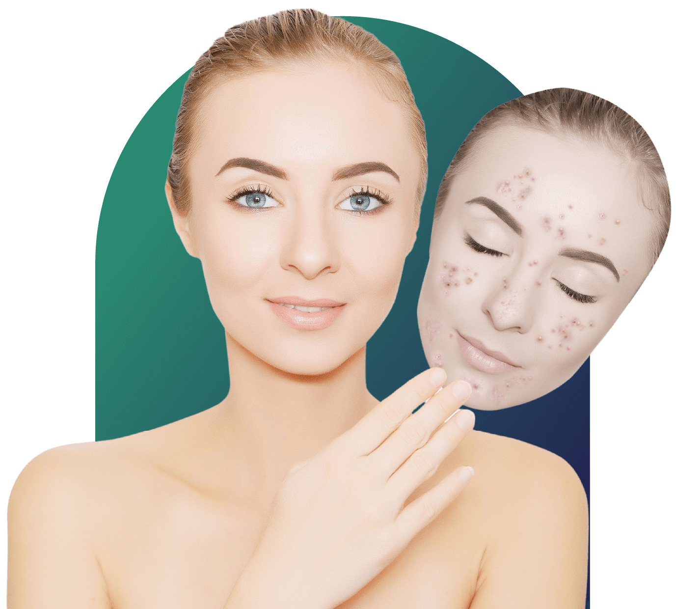 Dark Spot Marks Removal Treatment For Face And Skin Dark Spot Marks Removal Treatment For Face And Skin